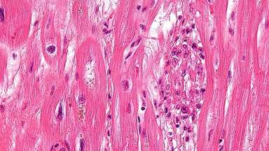 Heart Disease Analysis - rswilson32.github.io